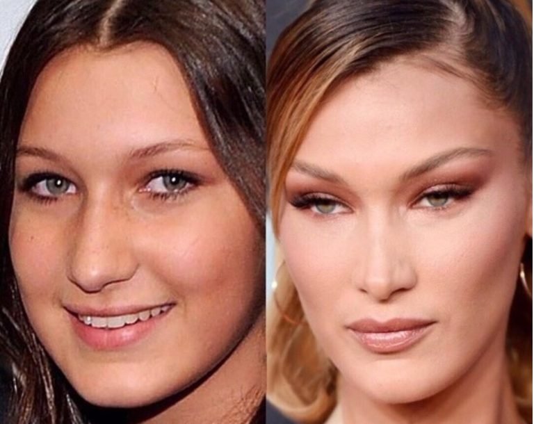 What the most beautiful woman in the world looked like before plastic ...