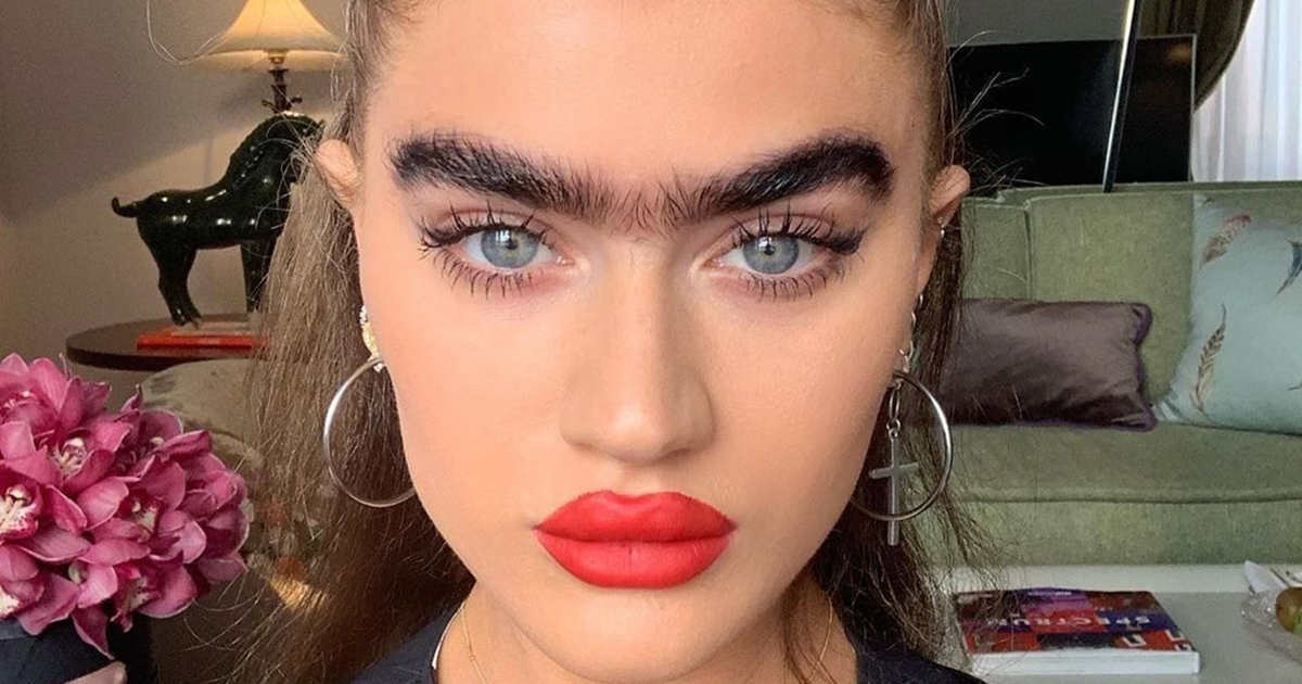 Remember the girl with the huge monobrow? This is how she lives and ...