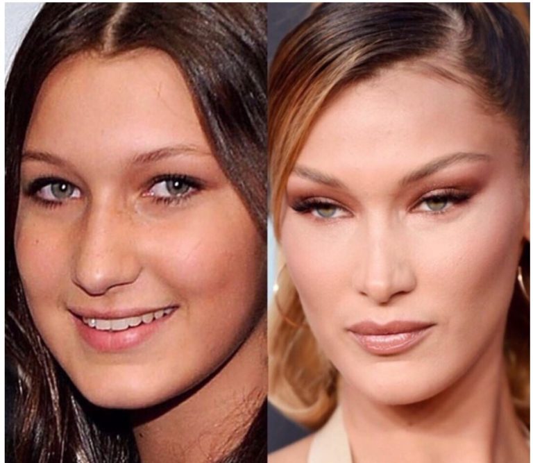 What the most beautiful woman in the world looked like before plastic ...