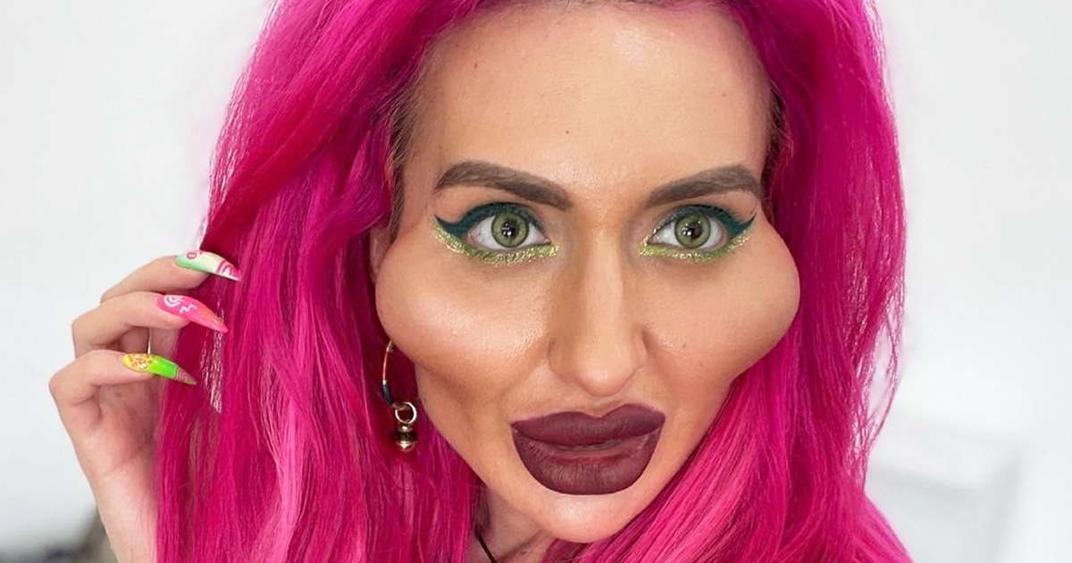 At 16 and Now: How the Ukrainian with the World's Biggest Cheekbones ...