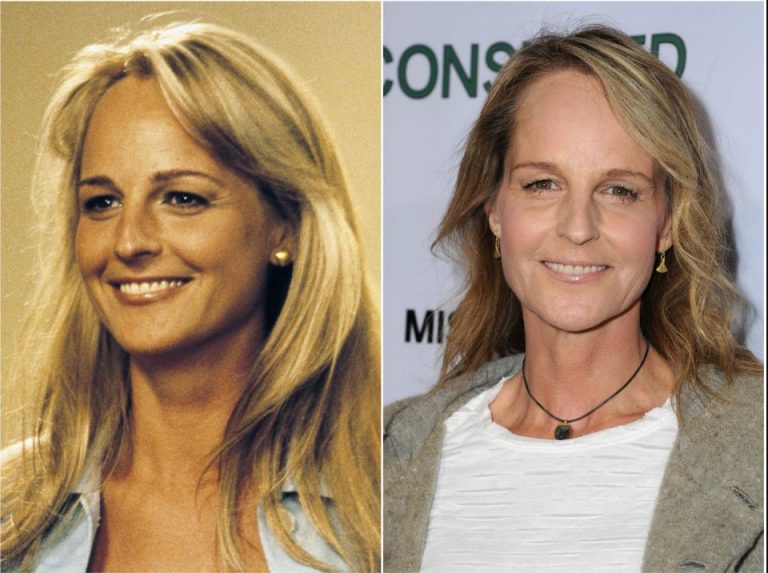 The Face Turned Into a Mask. The Star of "What Women Want" 59-year-old ...