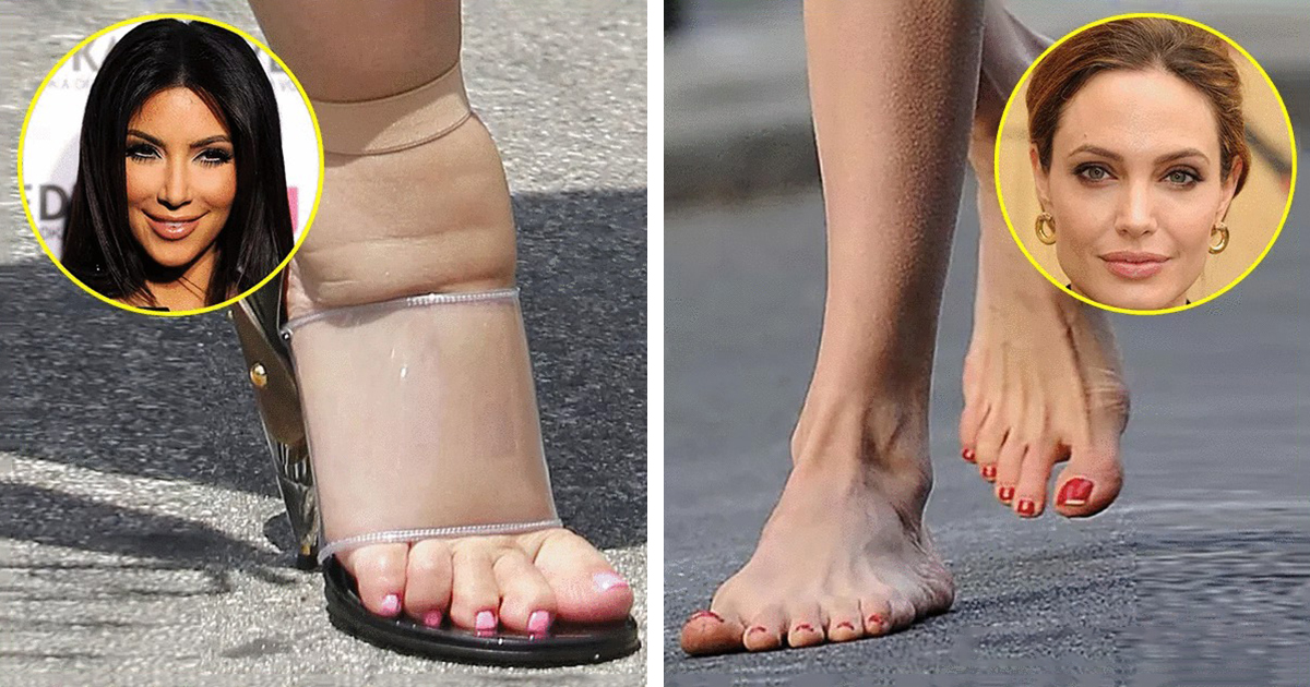 Twisted and Bruised. Unstarred Celebrity Legs Discussed on the Web ...