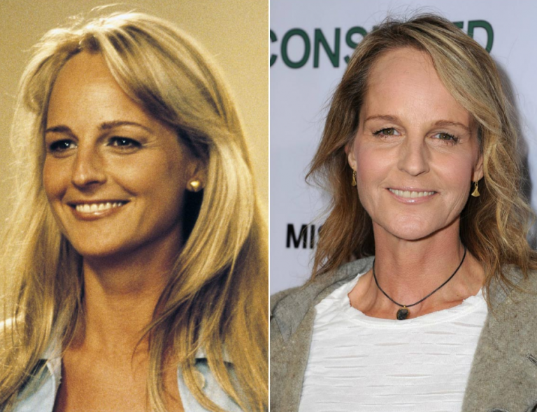 "From Oscar To Botox": How Did The Actress, Helen Hunt Ruin Her ...