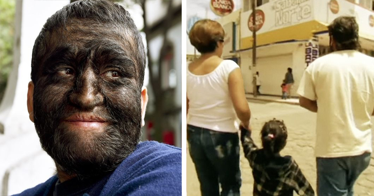 The Wolf Man Usually Stays In Isolation From People: The Daughters Of ...