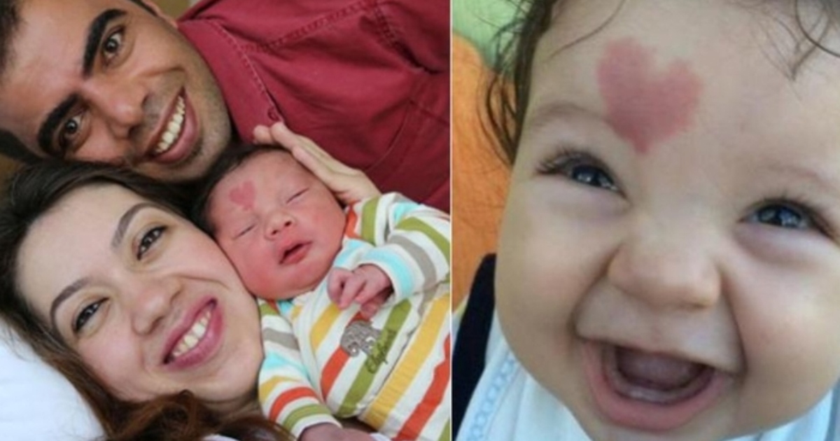 A Baby Born With A Heart-Shaped Birthmark On His Forehead: What Does He ...