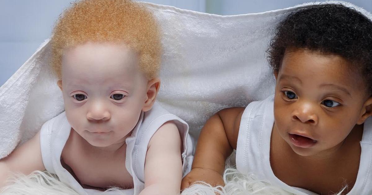 "Their Birth Was a Big Surprise For Everyone": What Do Twin Brothers ...