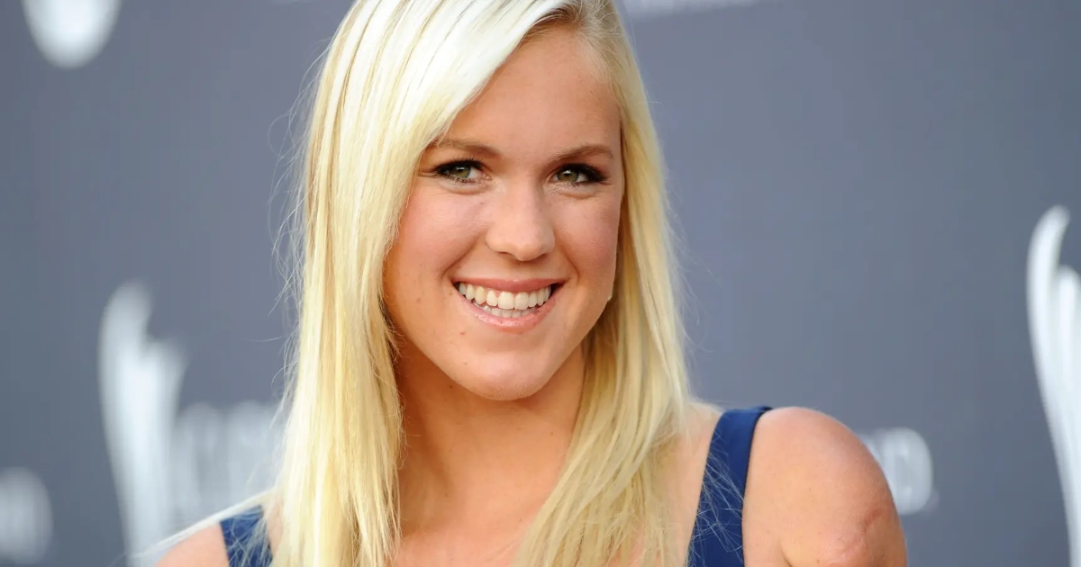 "Survived a Shark Attack And Lost Her Arm": The Heroic Woman Recently ...