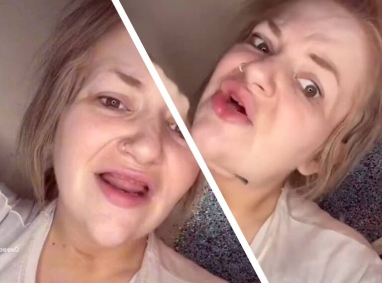 From a Toothless Woman To a Party Queen: Photos Of an Incredible ...