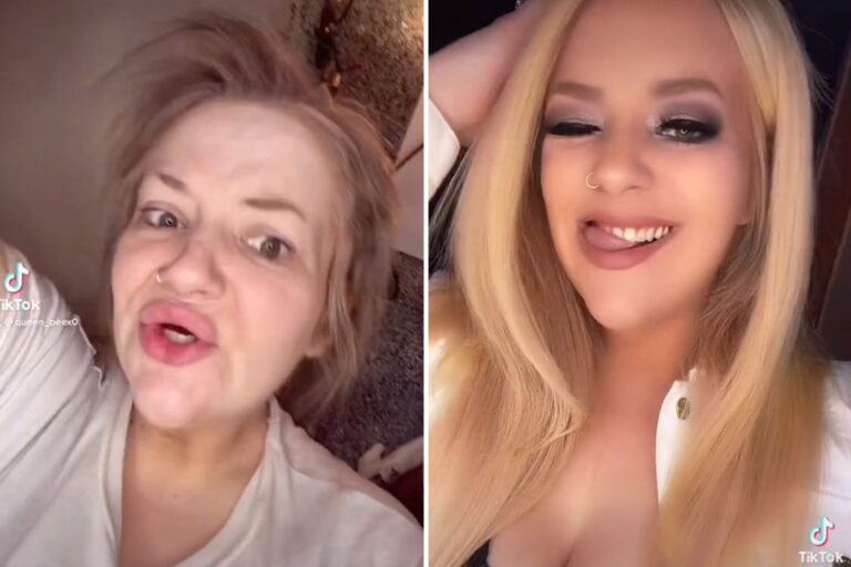 From a Toothless Woman To a Party Queen: Photos Of an Incredible ...