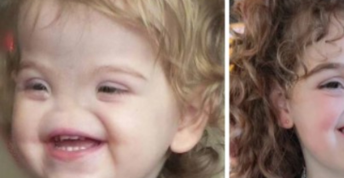 Iepazīsties ar meiteni, kura piedzima bez deguna: Daži sauc viņu par ...